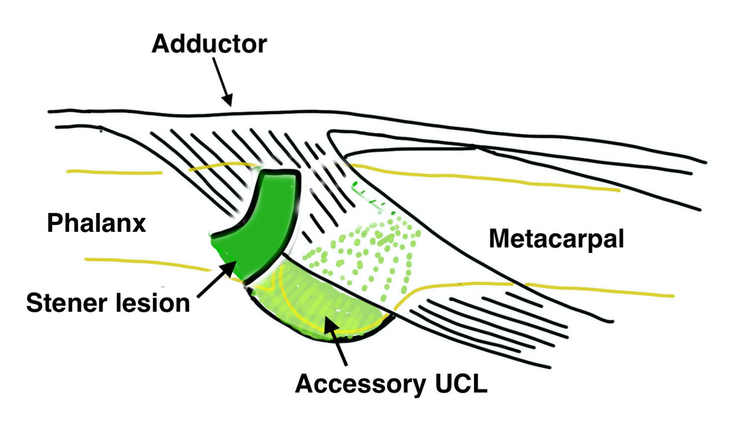 Ulna Collateral Ligament The Bone School